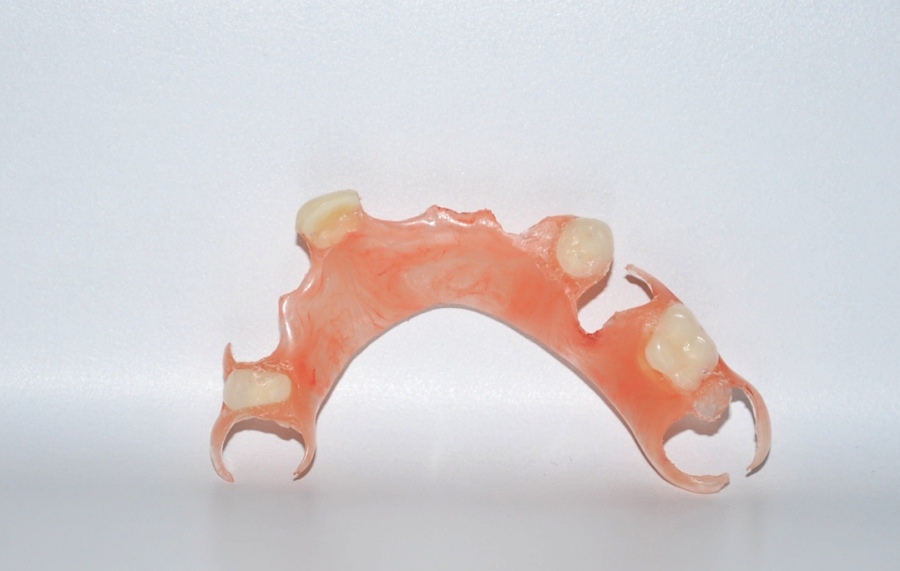 Protesis Flexibles (Deflex)